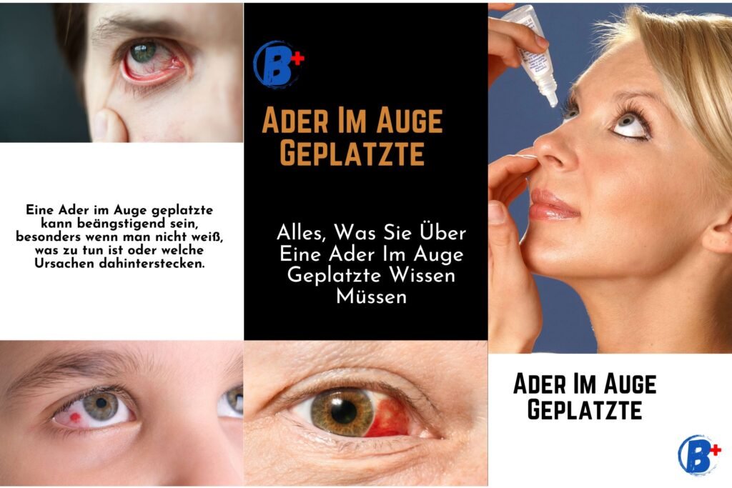 Alles, Was Sie Über Eine Ader Im Auge Geplatzte Wissen Müssen