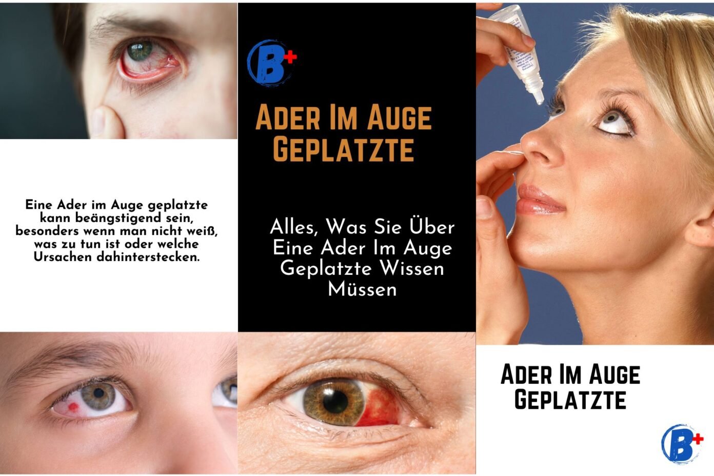 Alles, Was Sie Über Eine Ader Im Auge Geplatzte Wissen Müssen