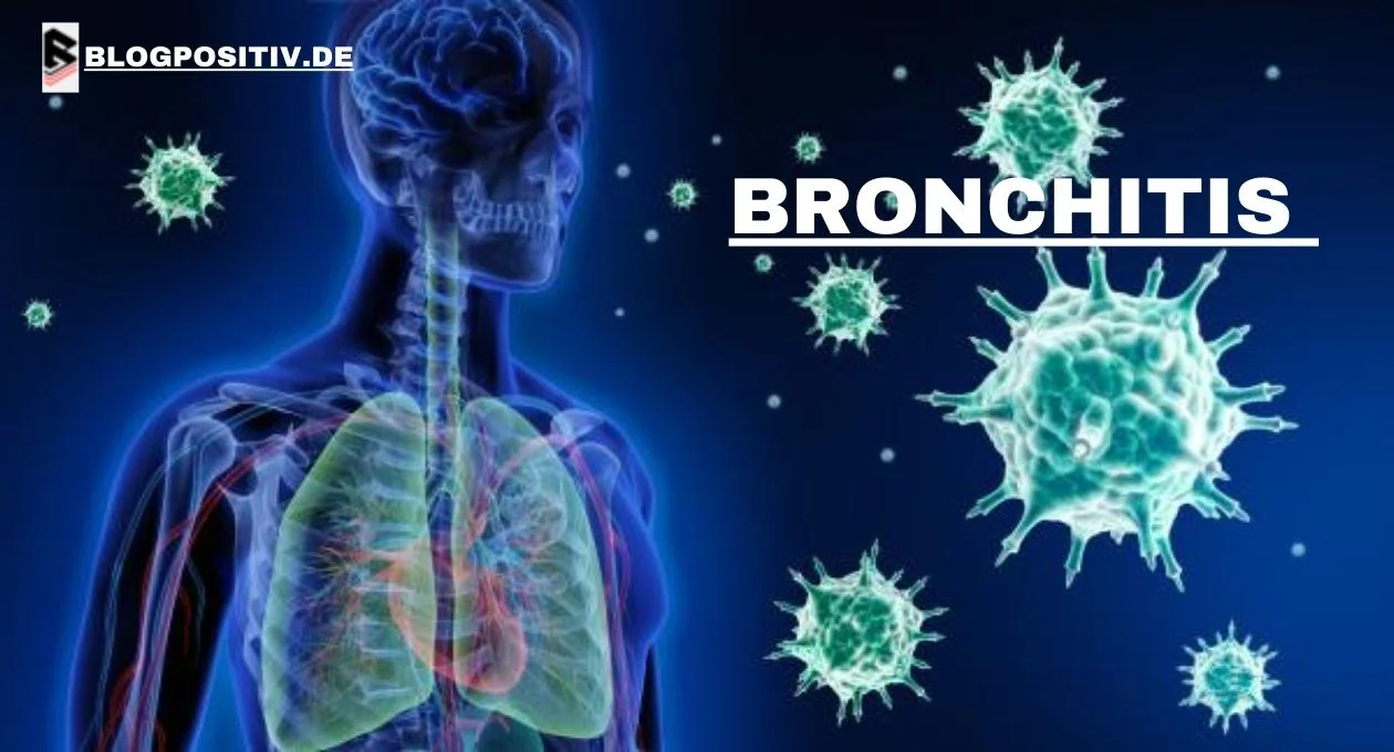 Bronchitis Ansteckend: Alles, Was Sie Wissen Müssen