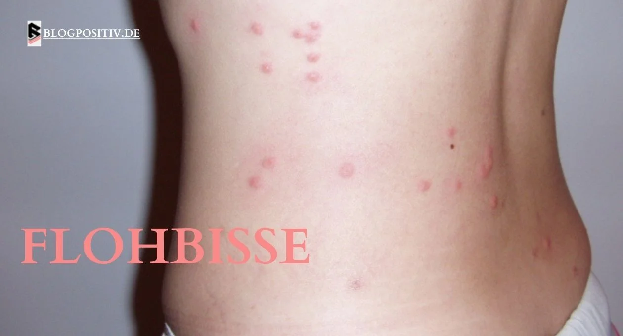 Flohbisse Erkennen Und Behandeln: Ein Leitfaden